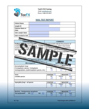 ToeFX PCR Test – ToeFX